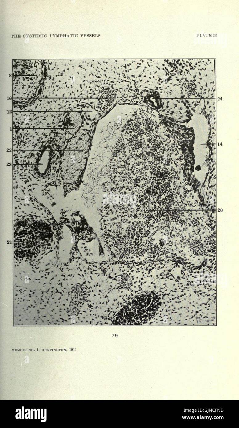 The anatomy and development of the systemic lymphatic vessels in the ...
