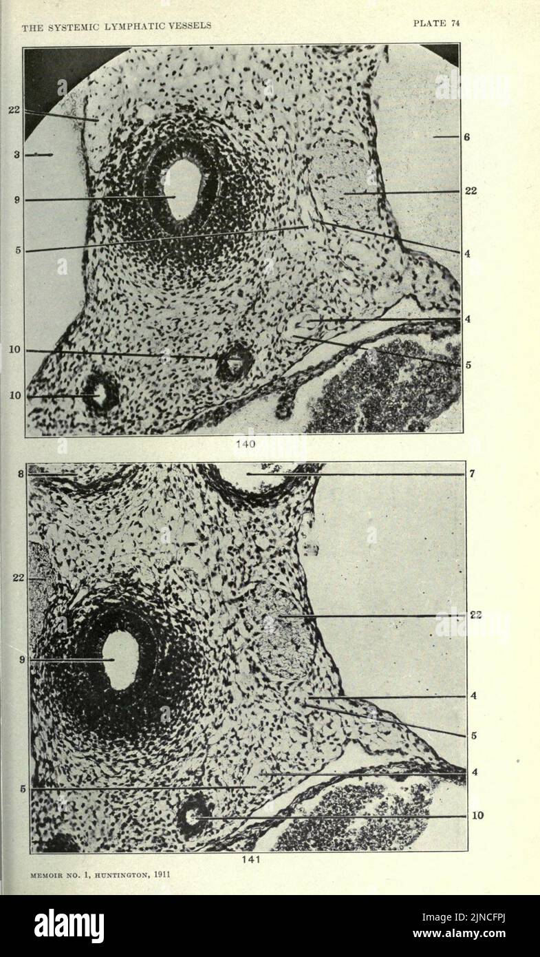 The anatomy and development of the systemic lymphatic vessels in the ...