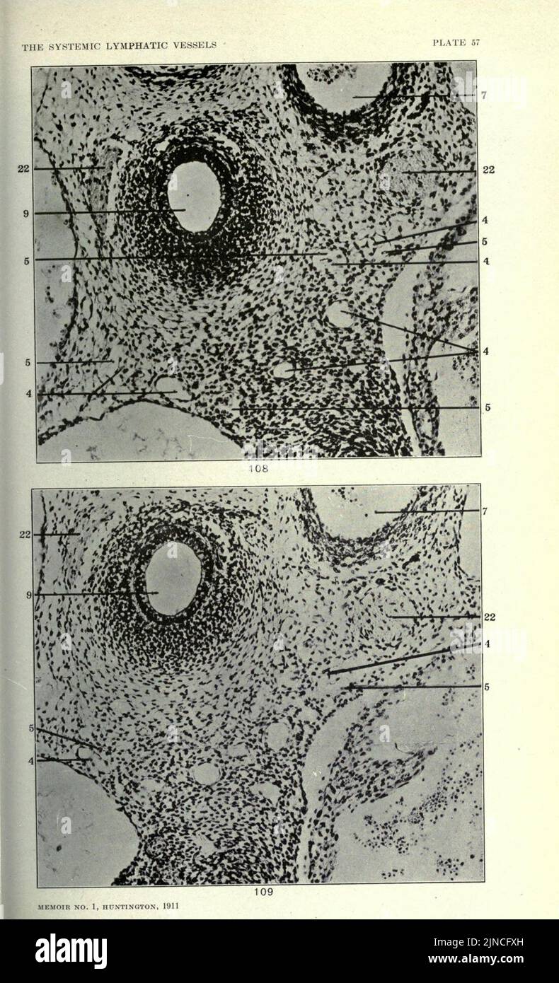 The anatomy and development of the systemic lymphatic vessels in the ...