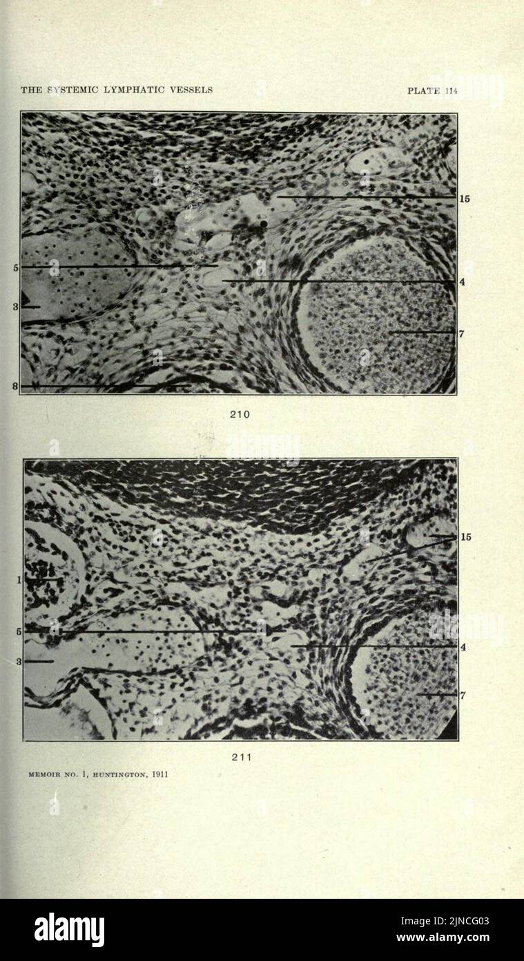 The anatomy and development of the systemic lymphatic vessels in the ...