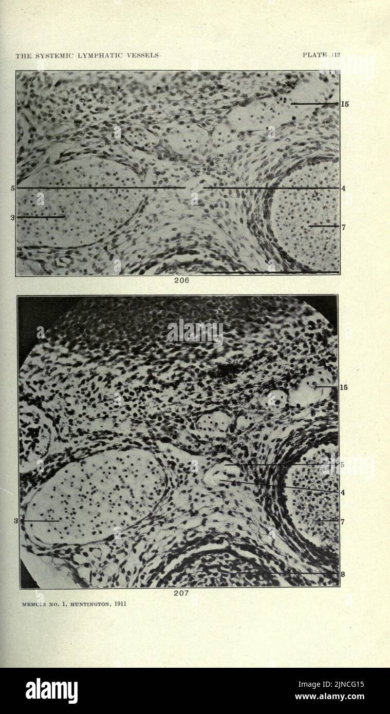 The anatomy and development of the systemic lymphatic vessels in the ...