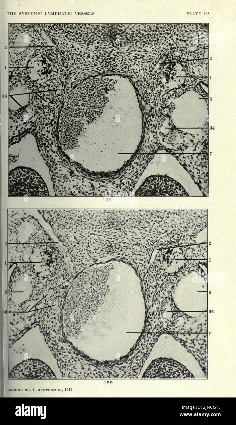 The anatomy and development of the systemic lymphatic vessels in the ...