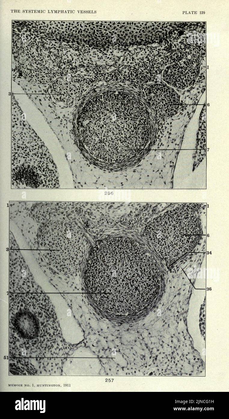 The anatomy and development of the systemic lymphatic vessels in the ...