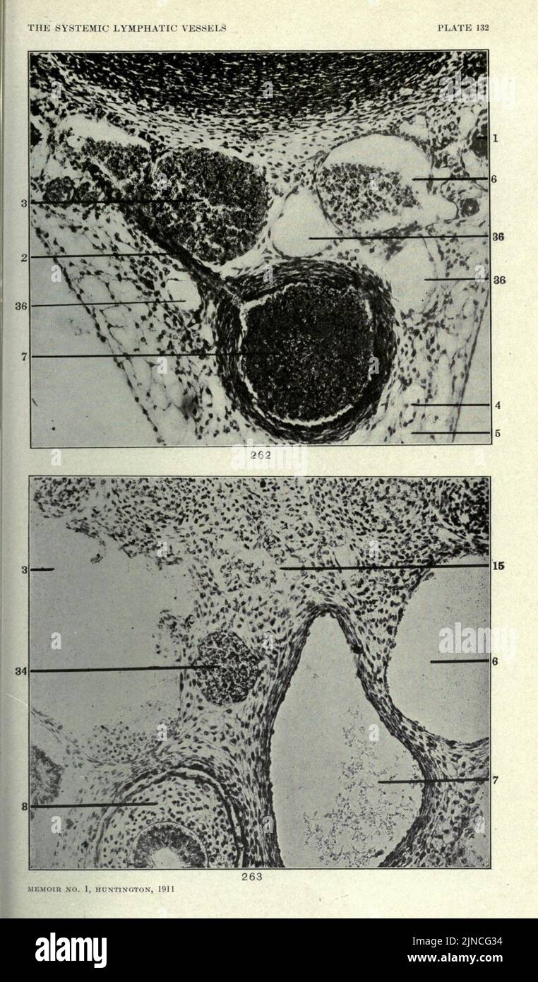 The anatomy and development of the systemic lymphatic vessels in the ...