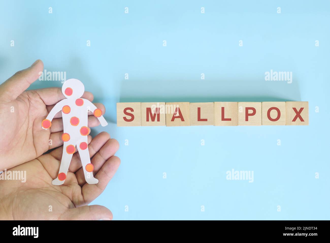 Smallpox disease infection outbreak care, prevention and protection ...