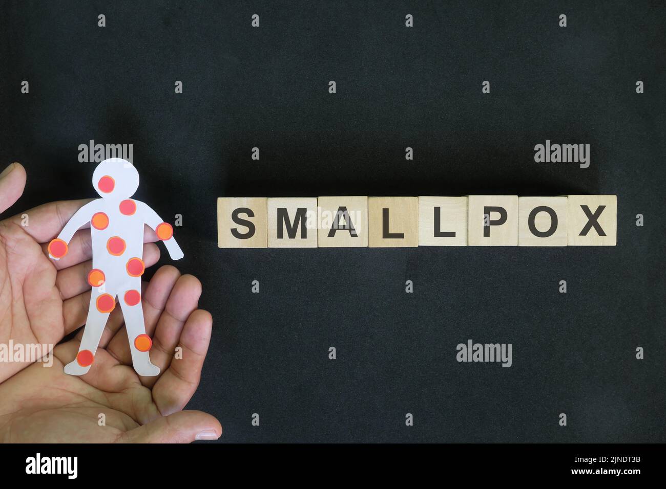 Smallpox disease infection outbreak care, prevention and protection ...