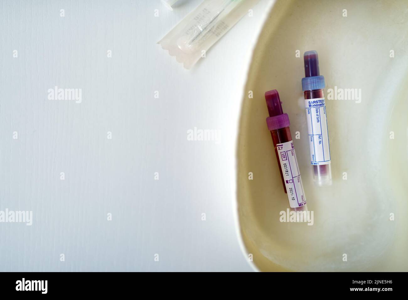 Horizontal view of samples of the patient's blood in closed tubes after ...