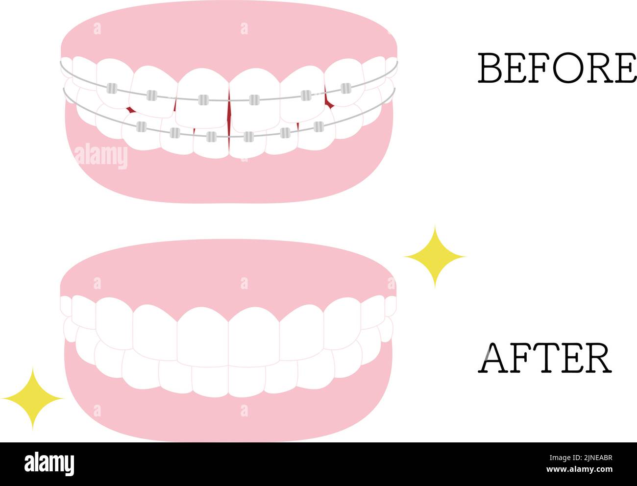 Distorted lips Stock Vector Images - Alamy