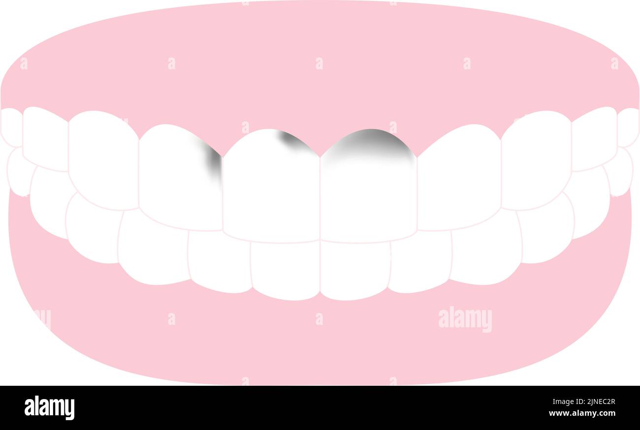 Advanced treatment Stock Vector Images - Alamy