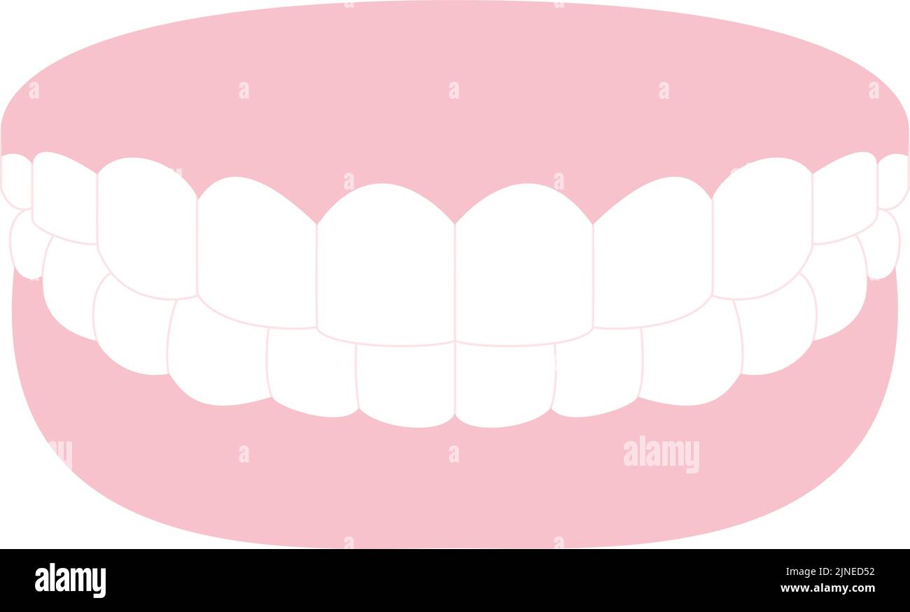 Aesthetic dentistry, illustration of white teeth and pink gums Stock ...
