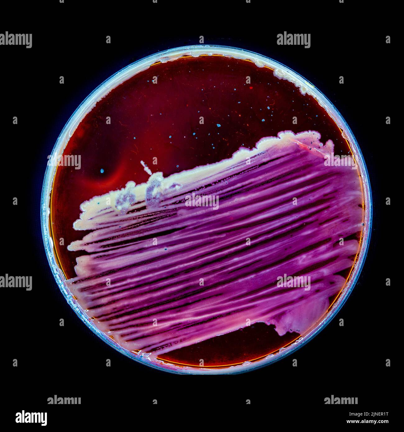 Samples of Petri dishes with a culture of microorganisms and fungi in the surface of agar ...