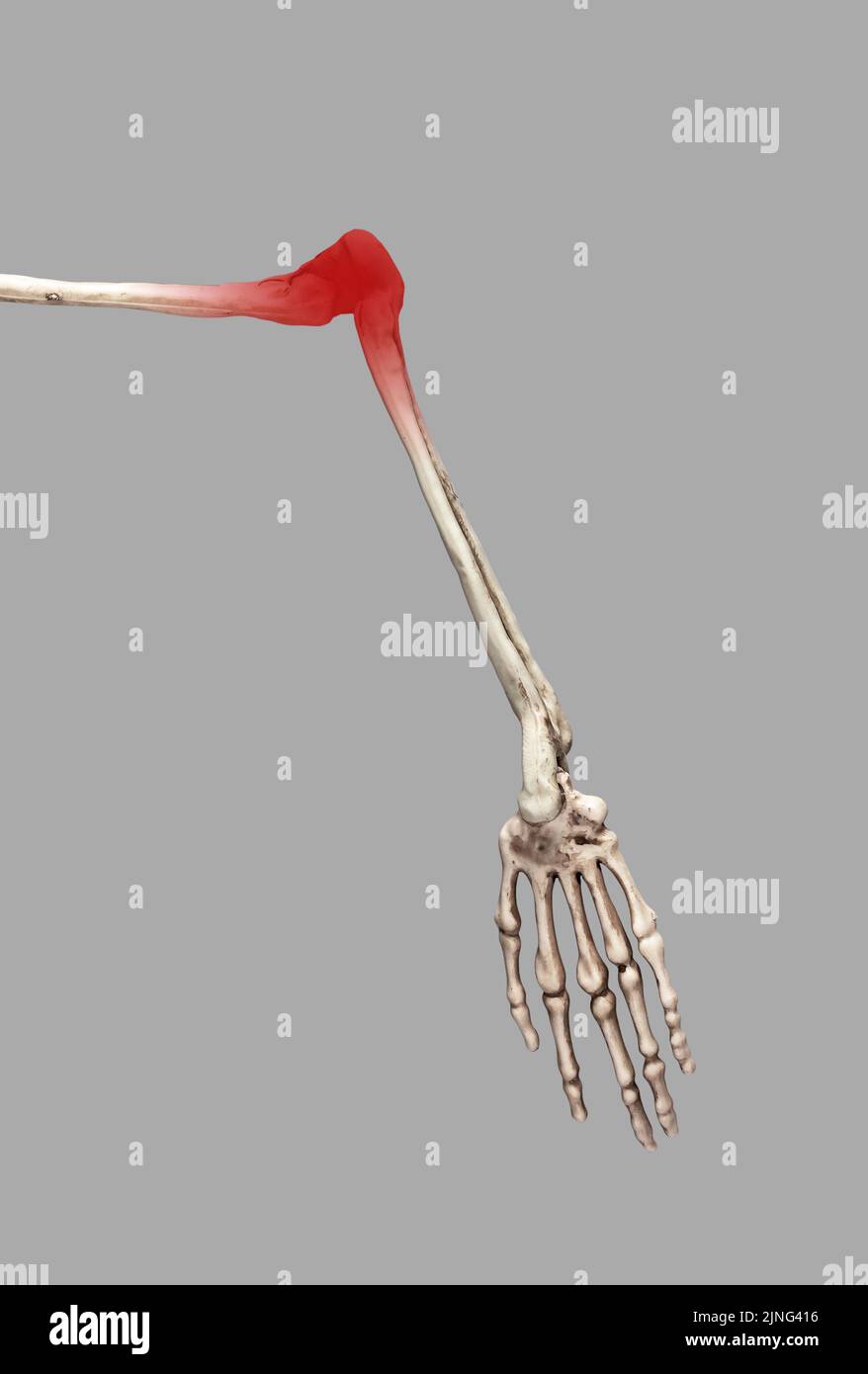 Human skeleton arm with red elbow. Sports trauma, injury, overuse ...