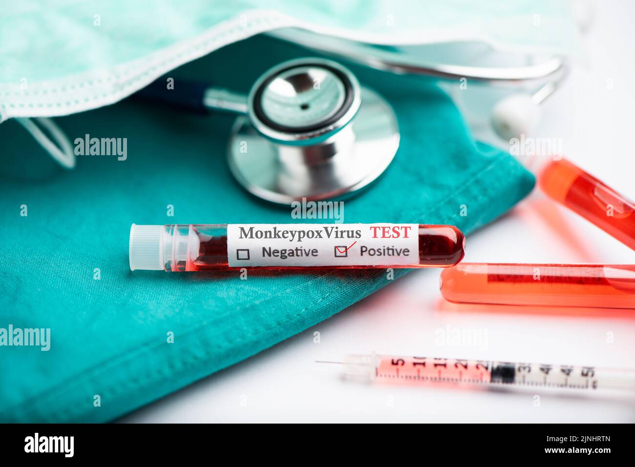 Monkey pox test tube on medical desk, monkeypox virus diagnosis concept ...