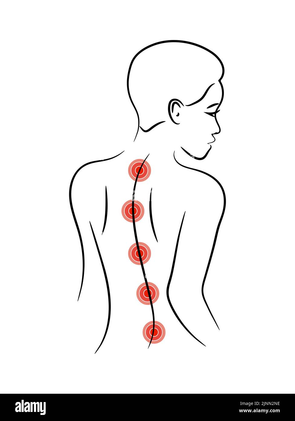 Back pain vector illustration. Spine Diagnostics logo design Stock ...