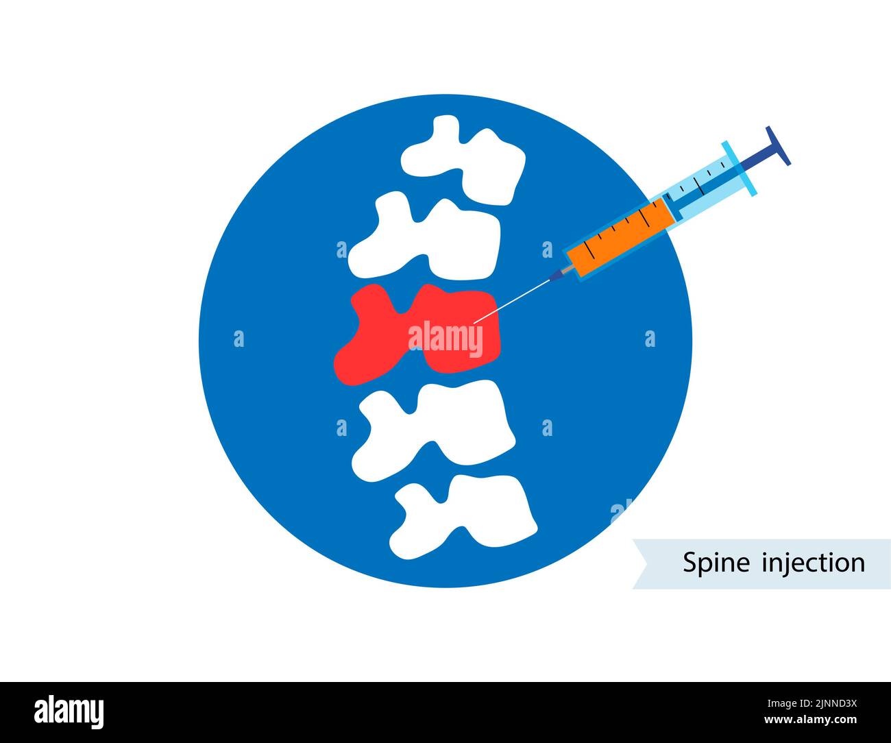 Lumbar epidural injection hi-res stock photography and images - Alamy