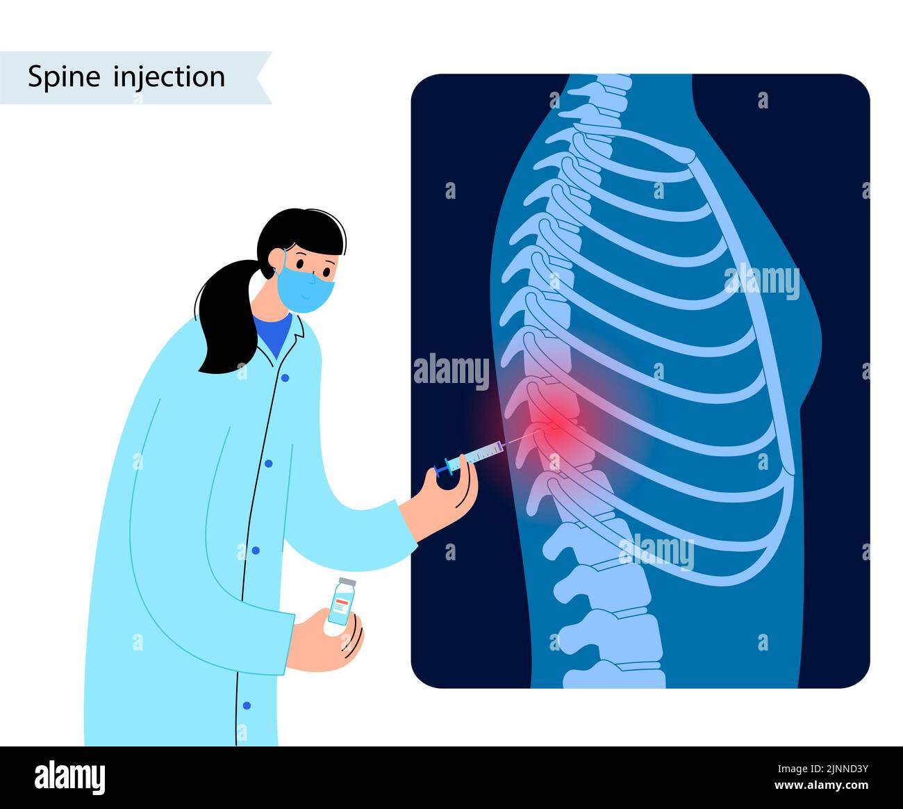 Lumbar epidural injection hi-res stock photography and images - Alamy
