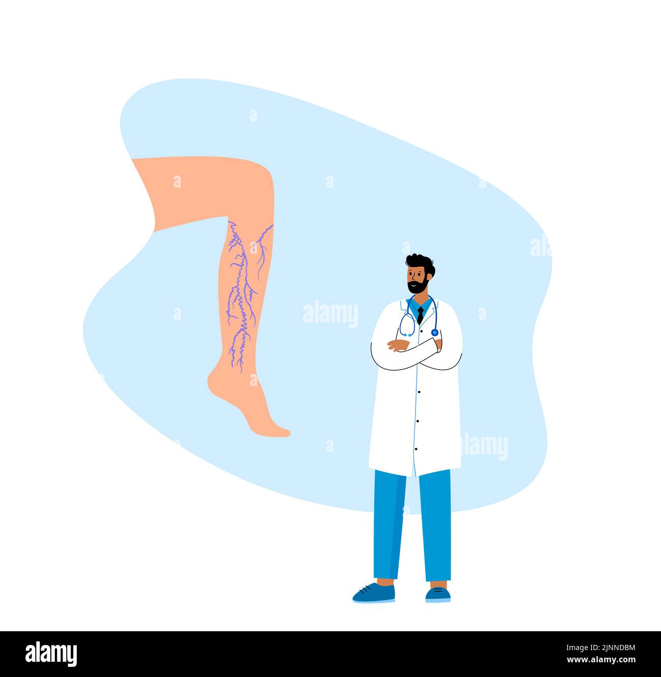Venous disease insufficiency vein Cut Out Stock Images & Pictures - Alamy