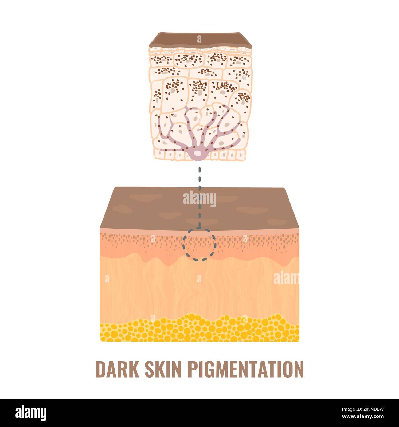 Skin pigmentation, illustration Stock Photo - Alamy