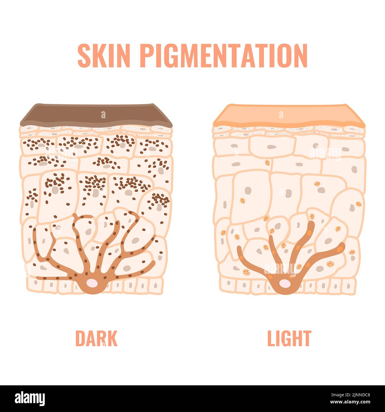 Skin pigmentation, illustration Stock Photo - Alamy