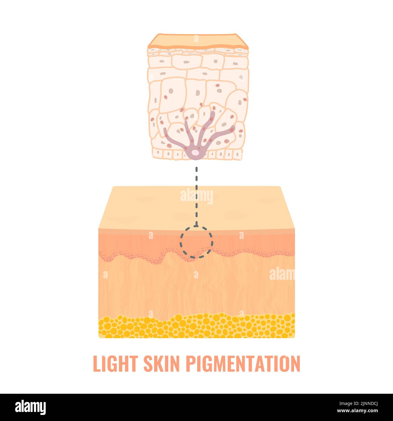 Skin pigmentation, illustration Stock Photo - Alamy