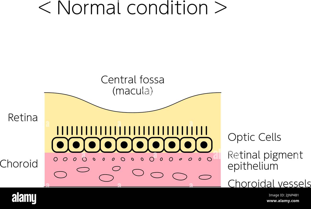 Normal retina hi-res stock photography and images - Alamy