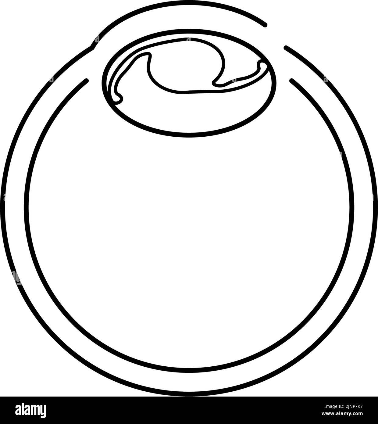 Cataract Surgery Flow, Illustration (Line Drawing), Inserting an ...