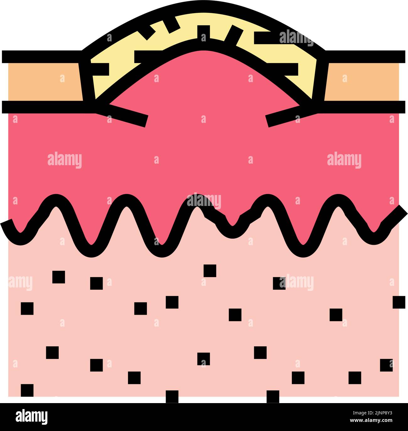 Surgical marks Stock Vector Images - Alamy