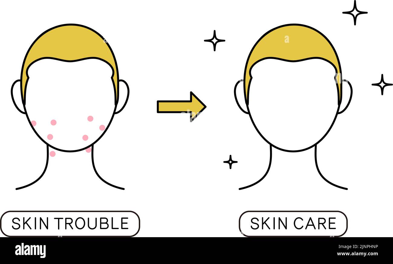 Image of skin care, from rough to smooth skin Stock Vector Image & Art ...