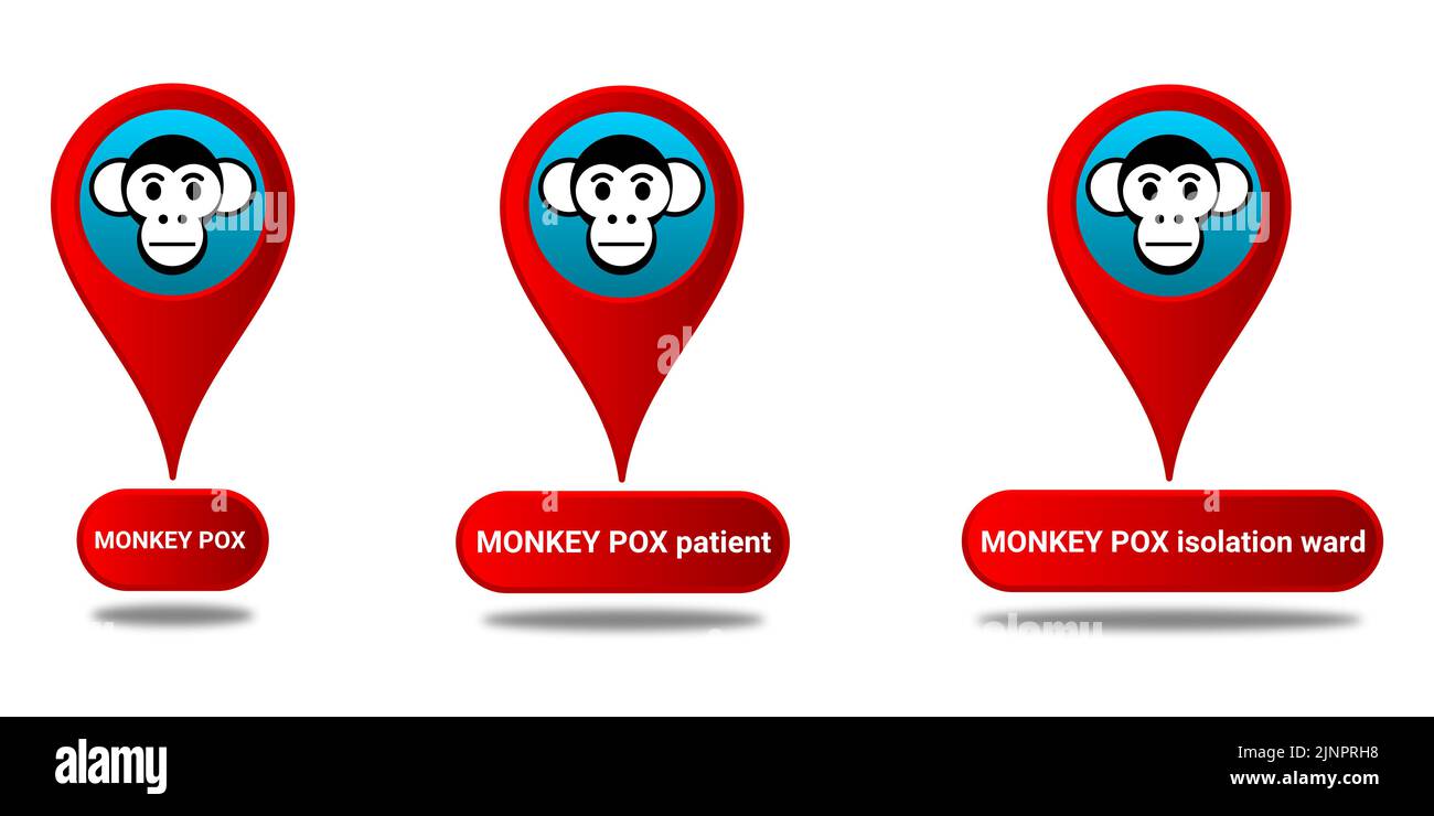 monkey pox, patient and isolation ward location with shadow ...