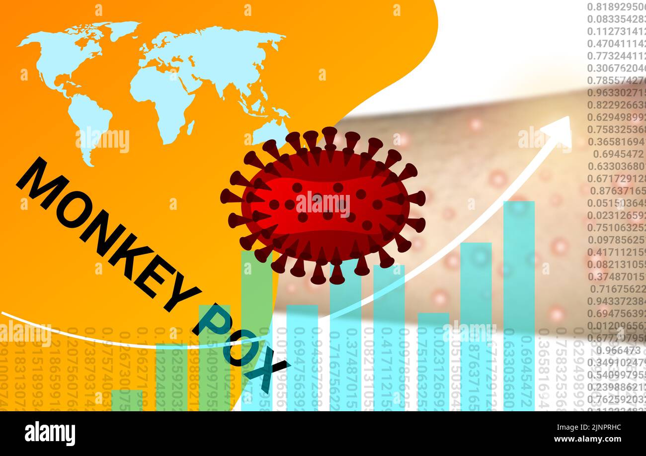 daily increasing monkey pox case background with graphs, numbers and ... daily increasing monkey pox case background with graphs, numbers and ...