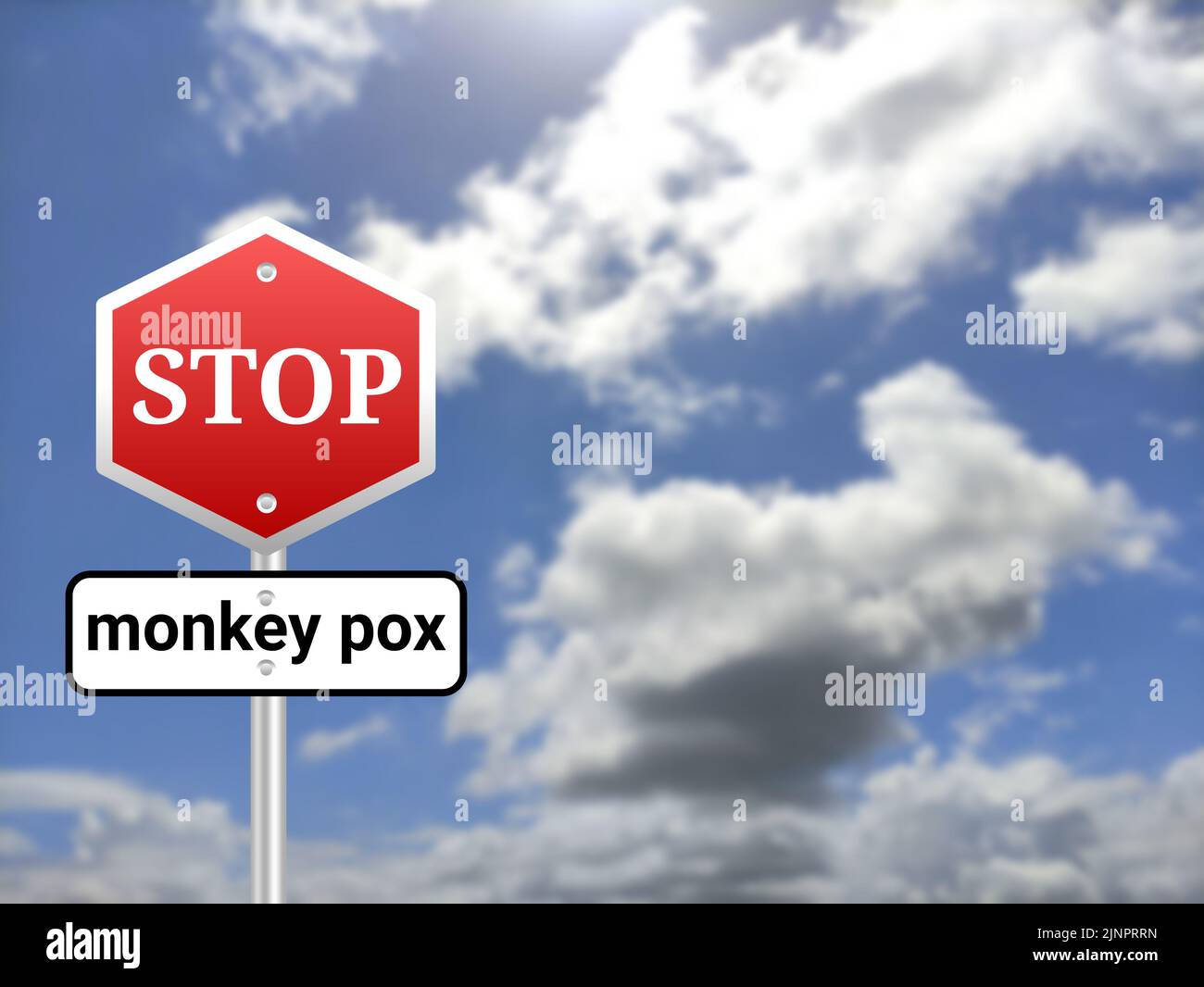 Stop monkey pox sigh board on blur sky background. monkey pox skin ...