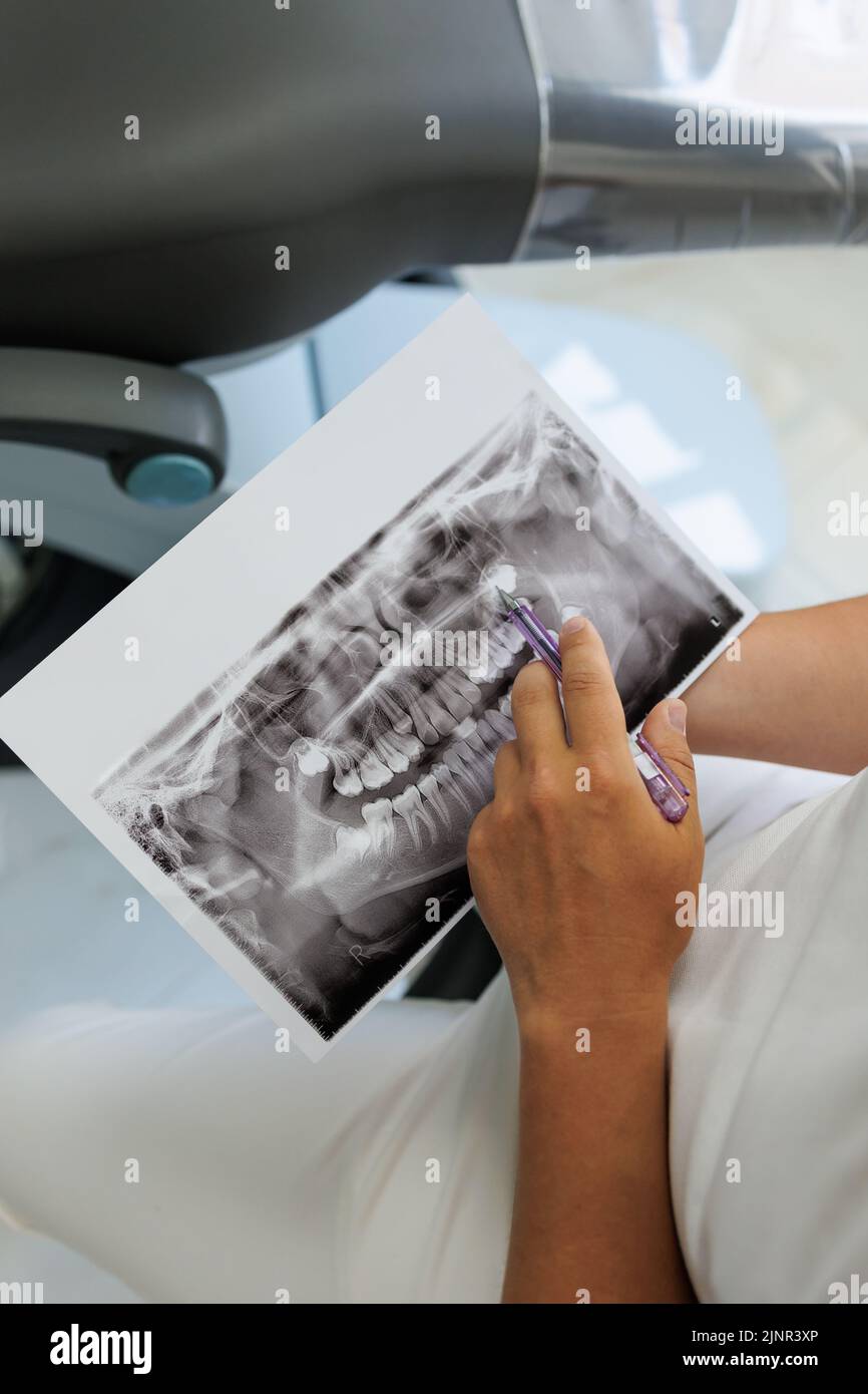 Close up view of male dentist doctor holding and looking at panoramic ...