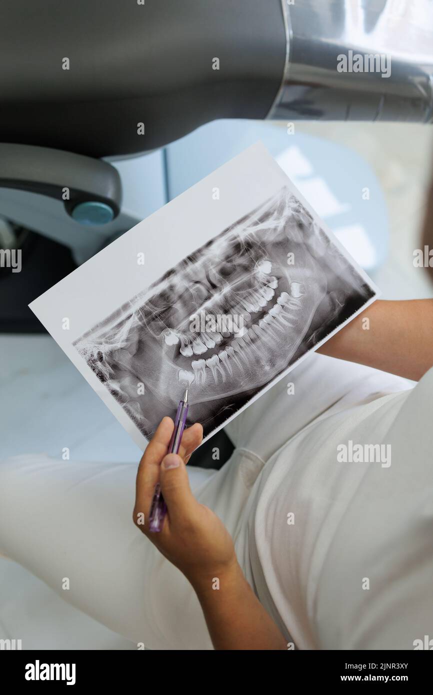 Teeth panoramic x ray professional examination Stock Photo - Alamy