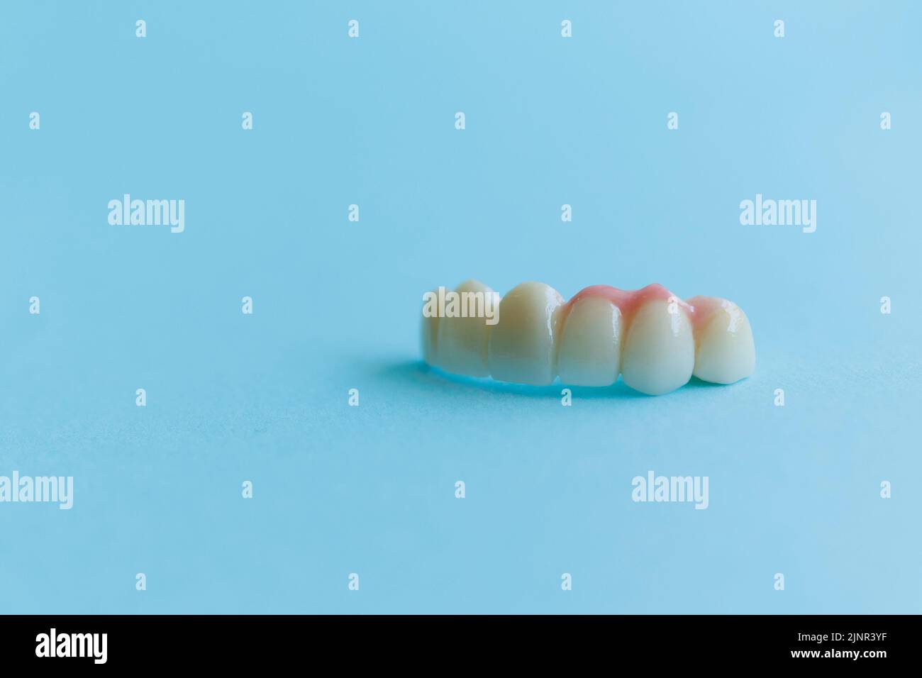 Artificial teeth on a blue background, dental crowns. Concept of dental ...