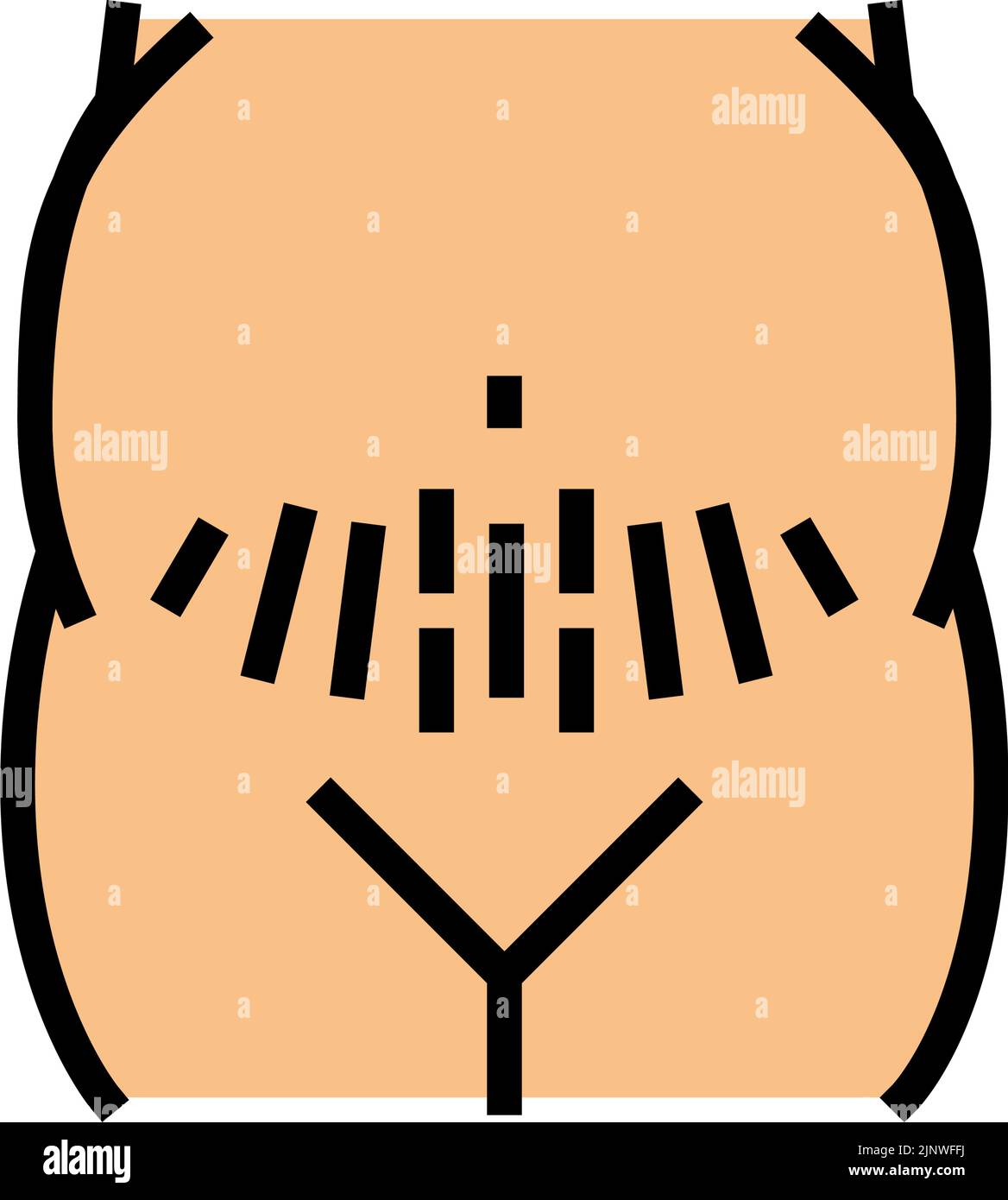 pregnancy stretch marks color icon vector illustration Stock Vector ...