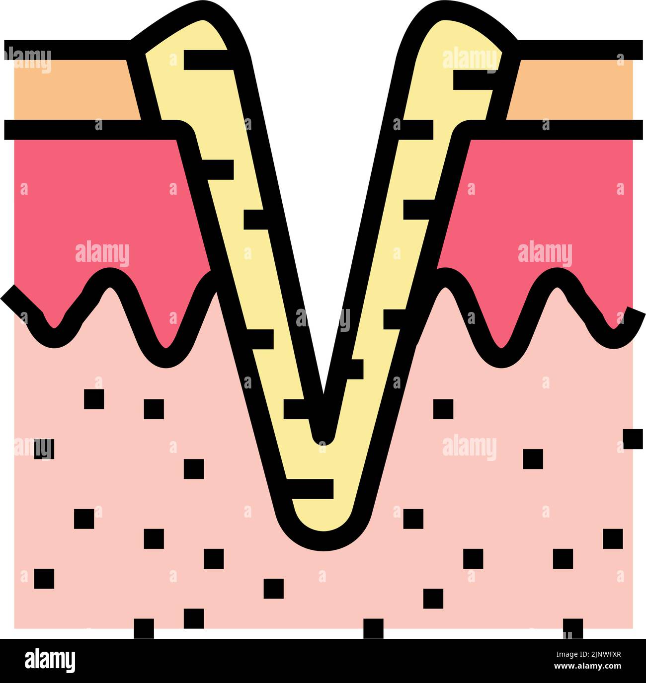 ice pick acne scar color icon vector illustration Stock Vector Image ...