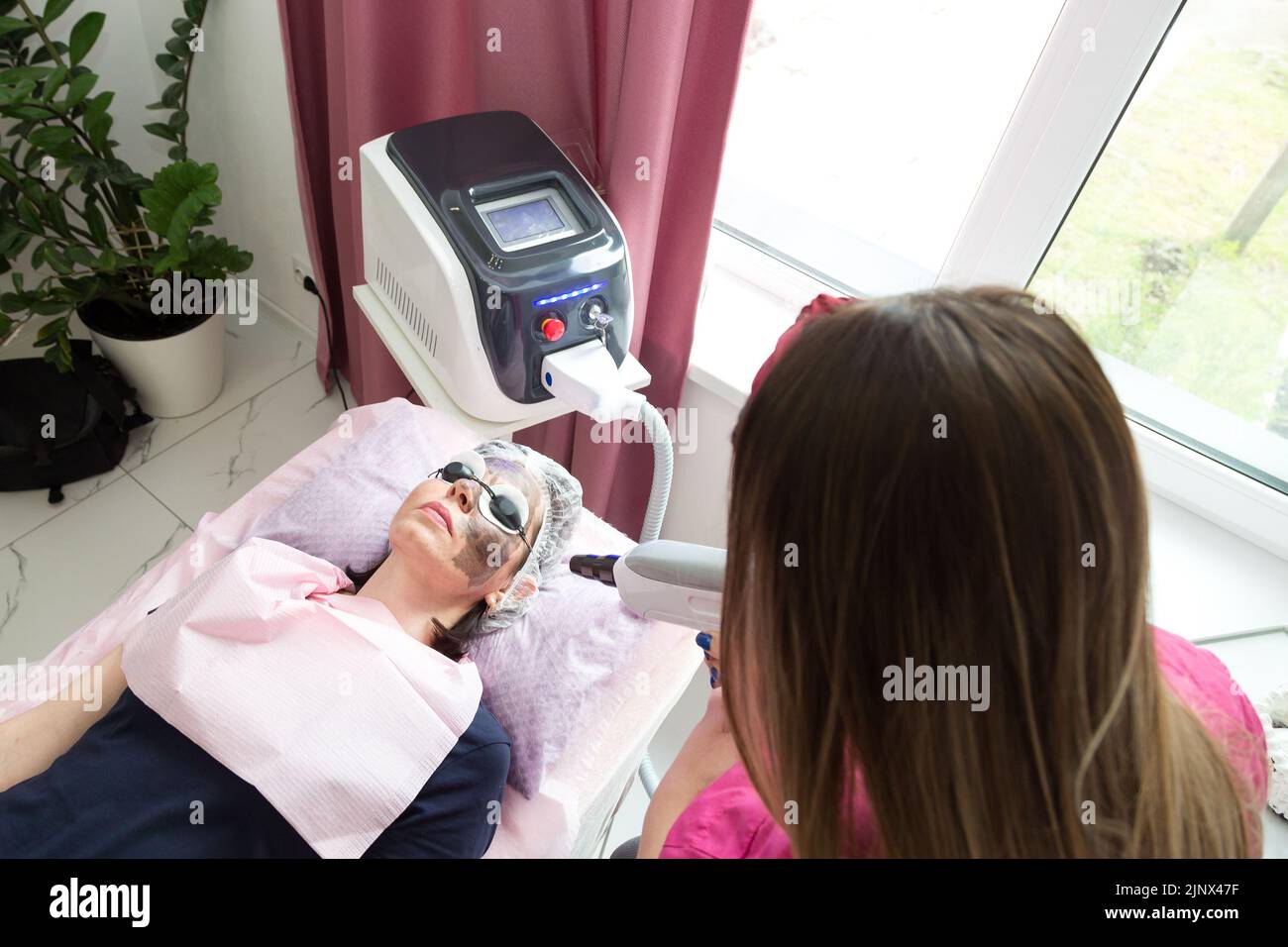 Laser peeling hi-res stock photography and images - Alamy