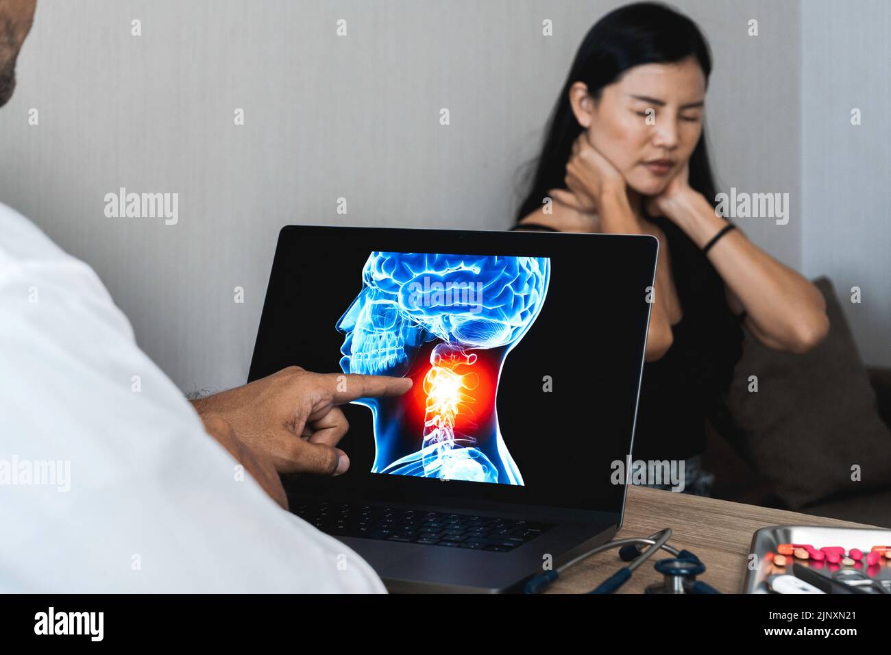 Doctor showing a x-ray of pain in the neck. Migraine Headache and ...