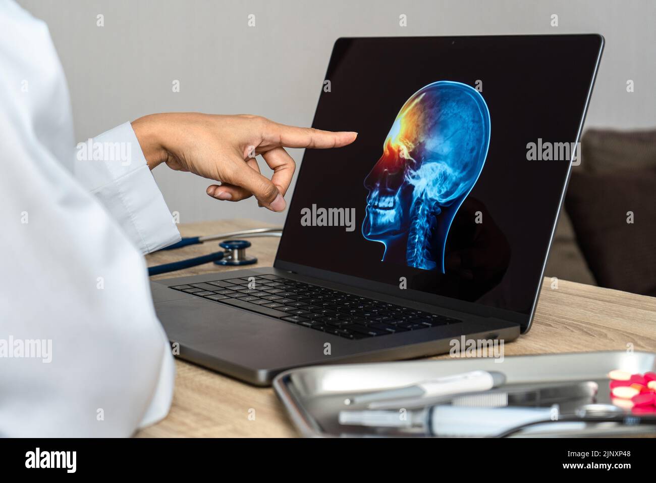 Traumatic brain injury mri hi-res stock photography and images - Alamy