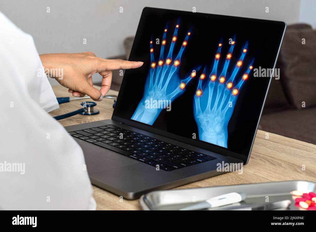 Close up of doctor showing x-ray of hands Stock Photo - Alamy