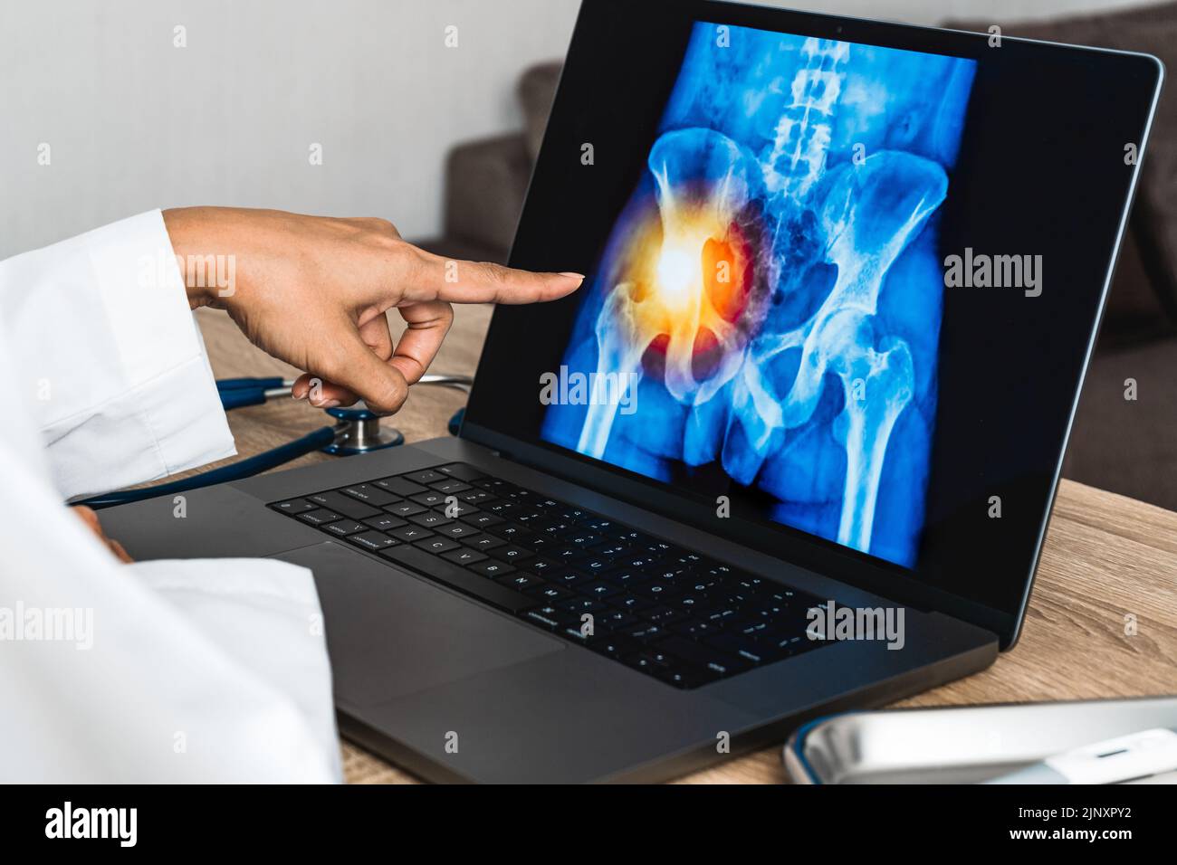 Close up of doctor showing a x-ray of pain in the hips on a laptop ...