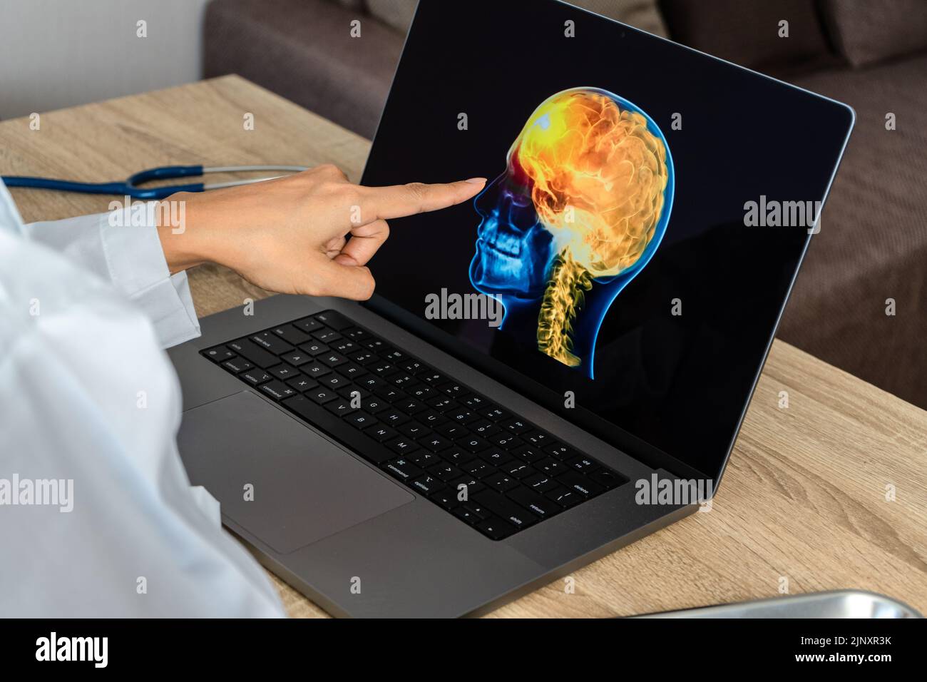 Close up of doctor looking a x-ray of pain in the brain on a laptop ...