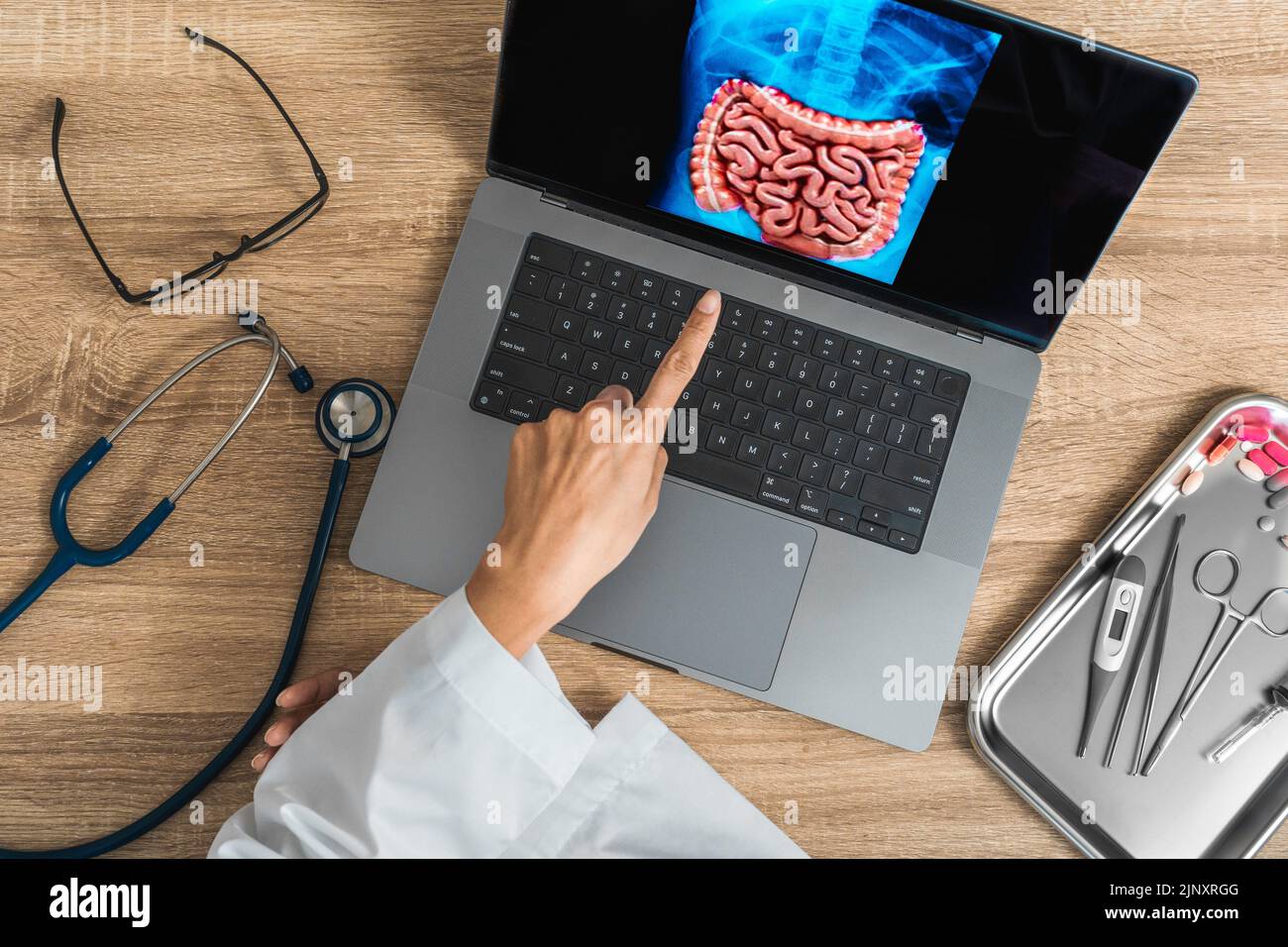 Top view of doctor showing a x-ray of stomach and intestine Stock Photo ...
