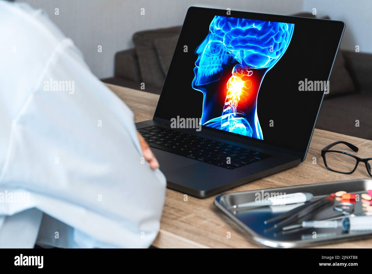 Doctor showing a x-ray of pain in the neck. Migraine Headache and ...