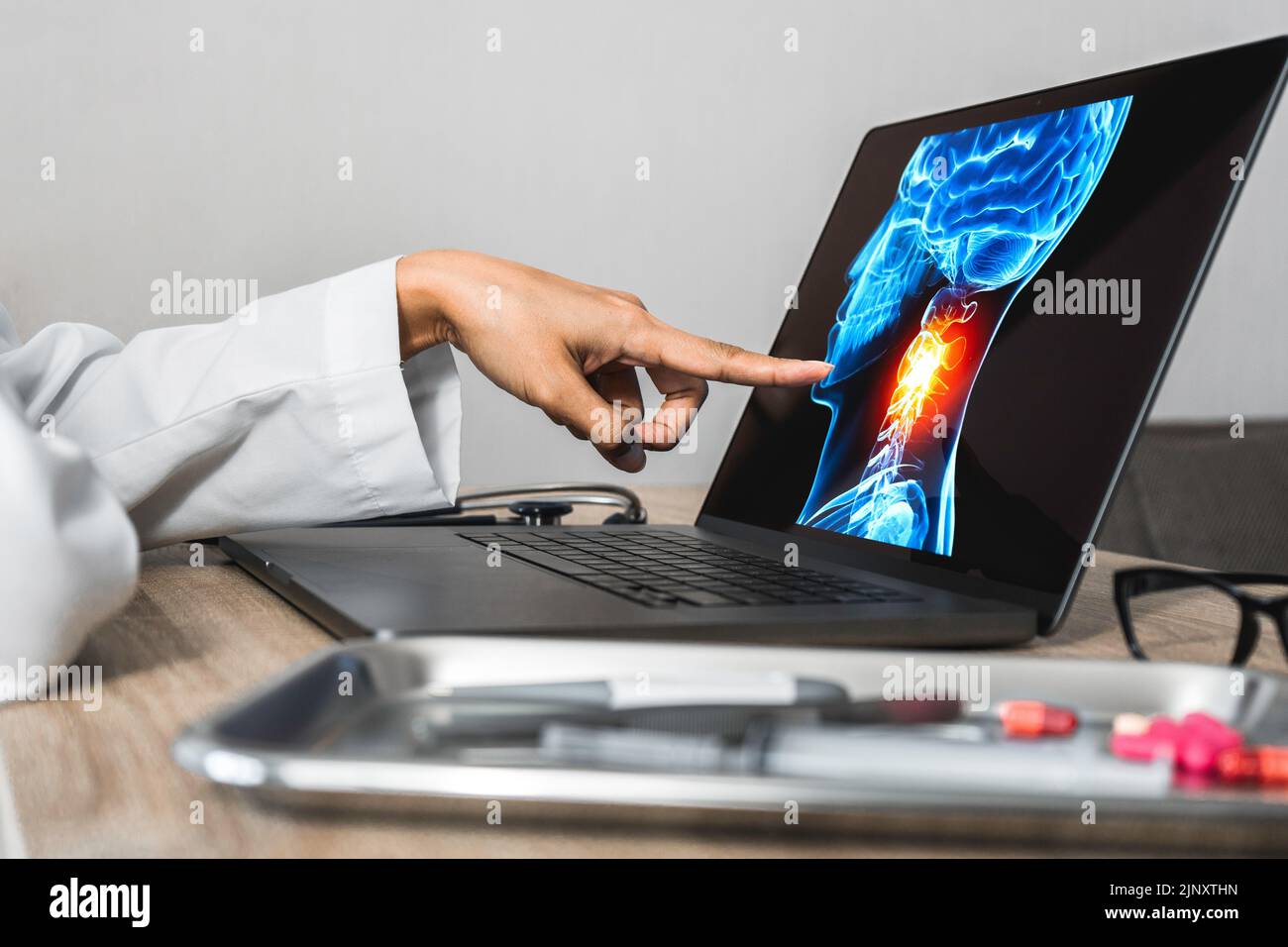 Doctor showing a x-ray of pain in the neck. Migraine Headache and ...