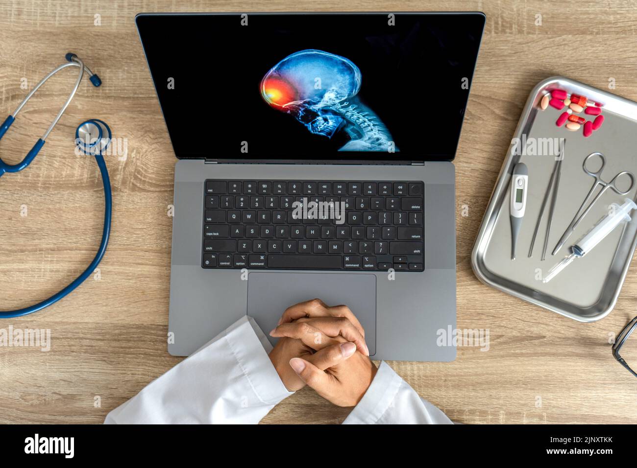 Traumatic brain injury mri hi-res stock photography and images - Alamy