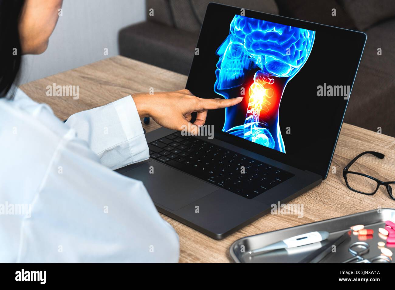 Doctor showing a x-ray of pain in the neck. Migraine Headache and ...