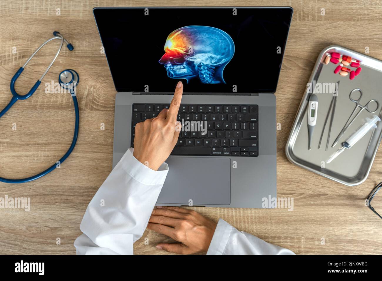 Top view of doctor showing a x-ray of pain in the brain on a laptop ...