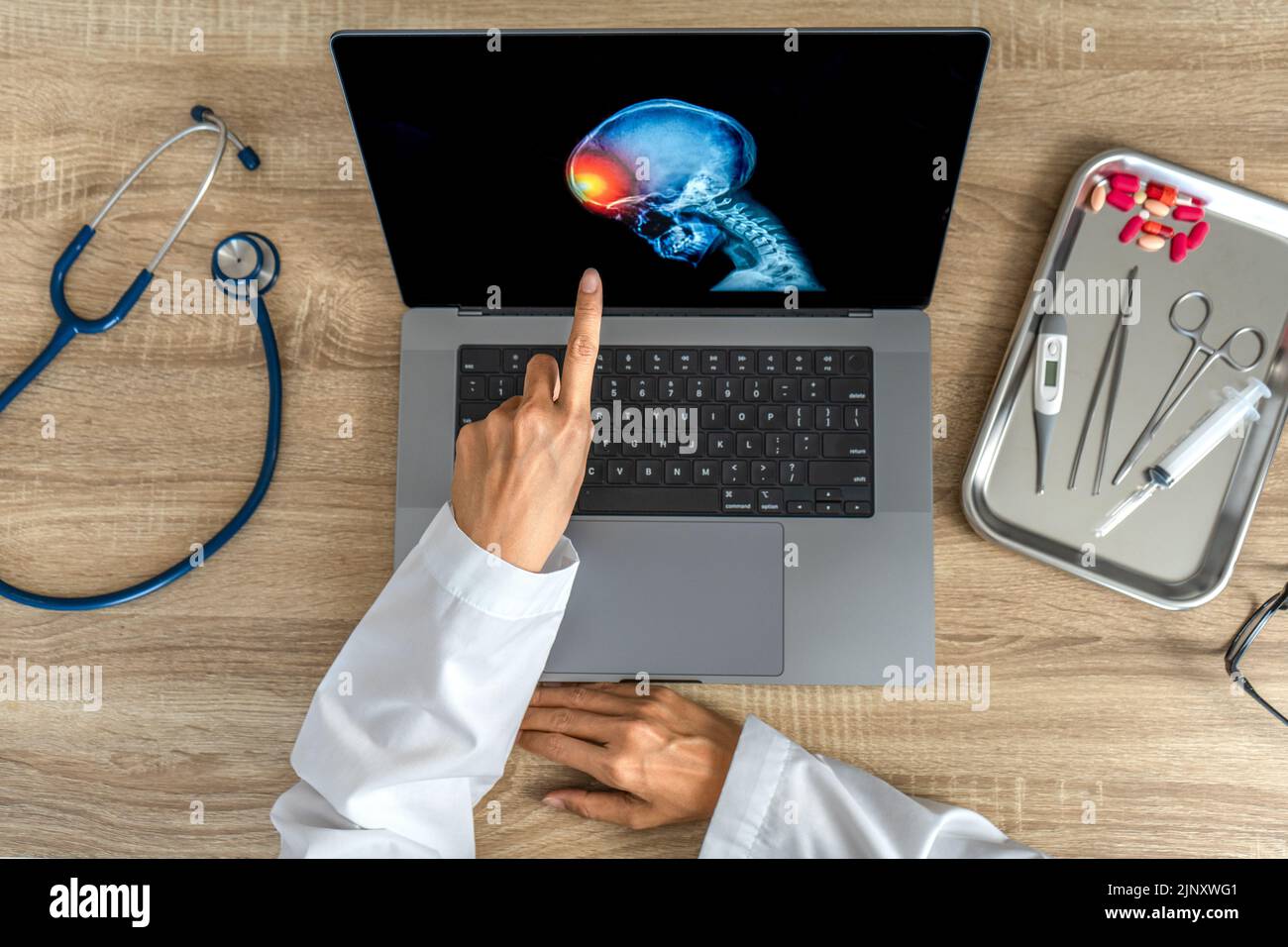 Top view of doctor showing a x-ray of pain in the brain on a laptop ...