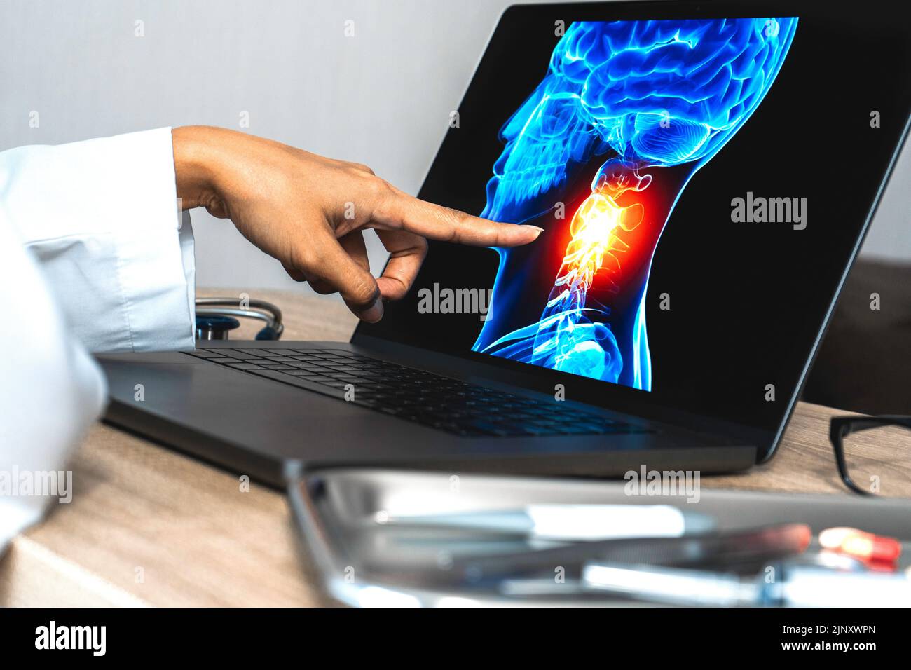 Doctor showing a x-ray of pain in the neck. Migraine Headache and ...